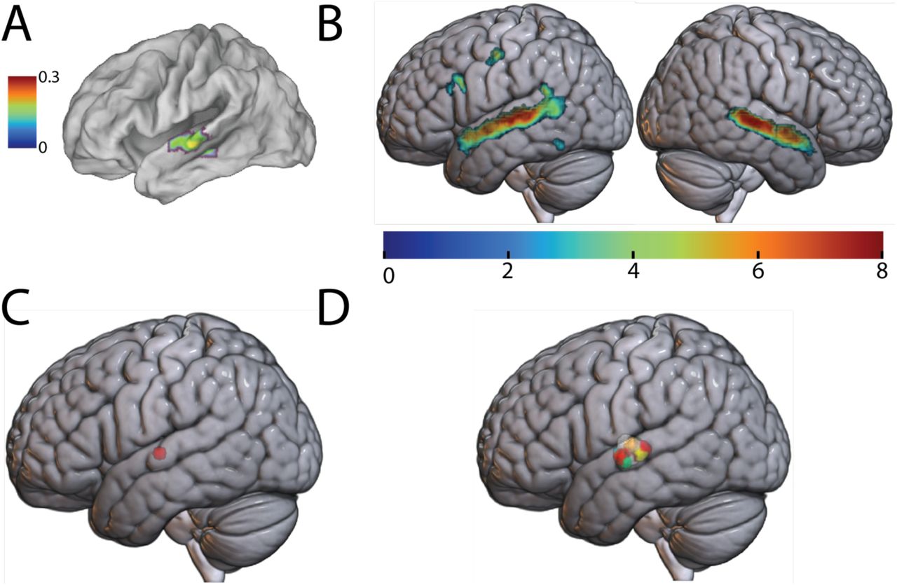 An auditory lexicon in the brain - Center for Neuroengineering